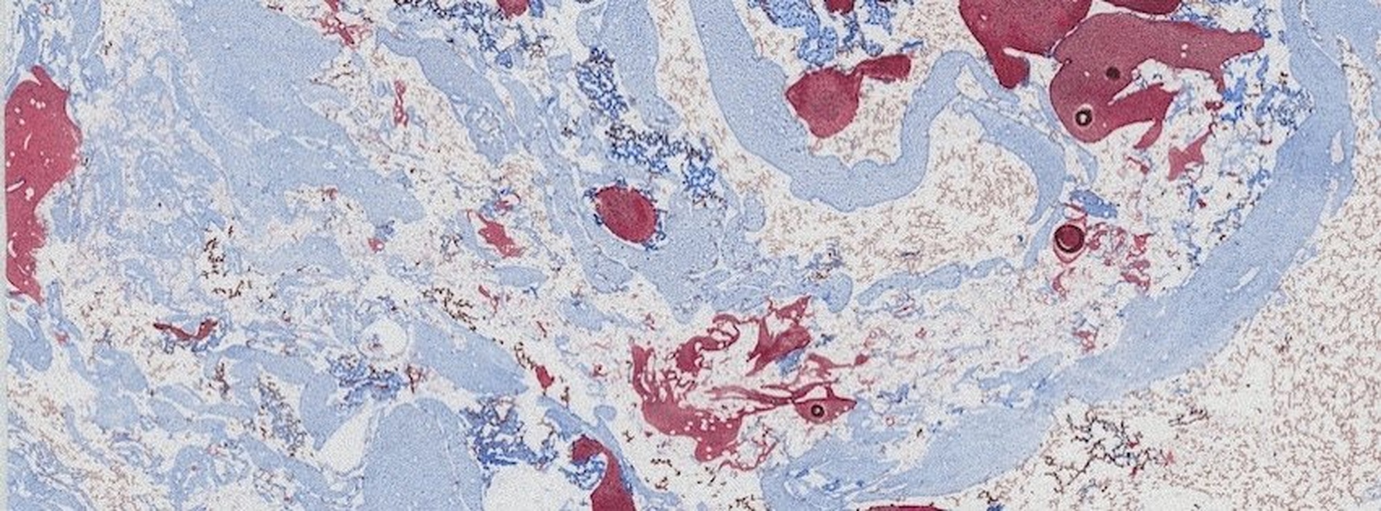 Picture of Roo Panes