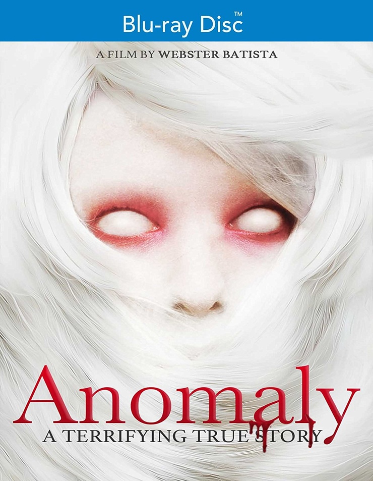 Picture of Anomaly