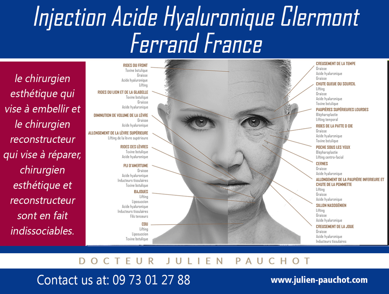 injection acide hyaluronique clermont ferrand |htt