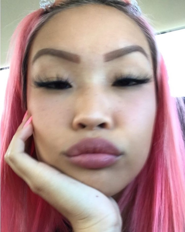 Image of Chinqpink