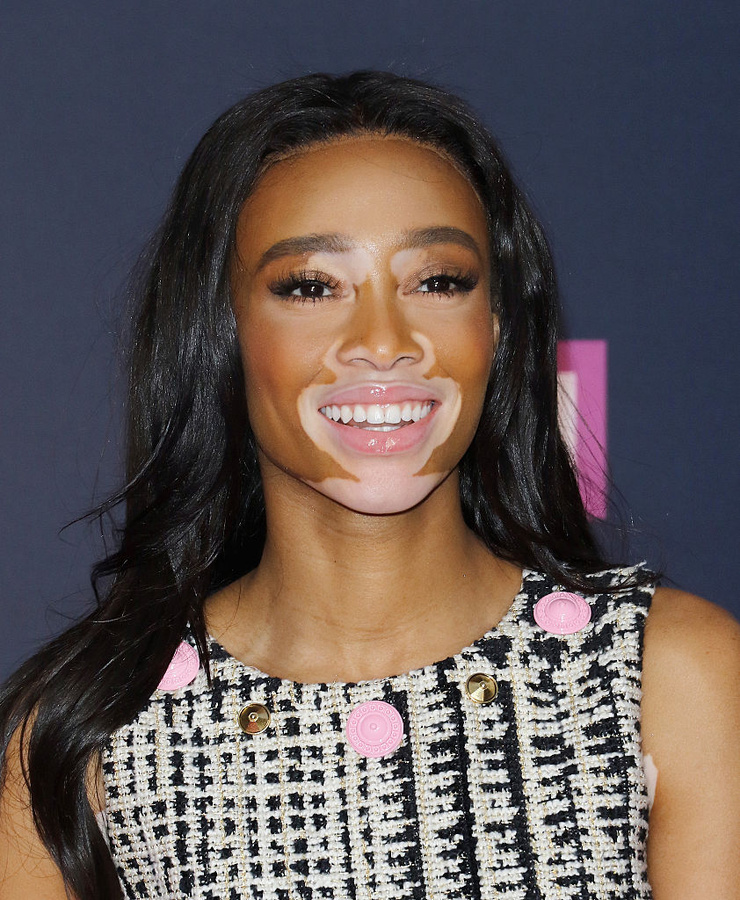 Picture of Winnie Harlow