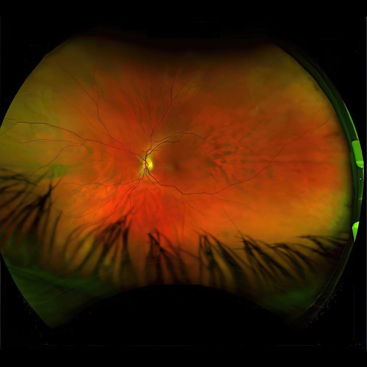 Picture of Mirrorcell