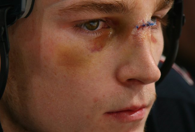 Image of Rick Rypien