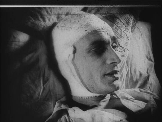 Picture of The Hands of Orlac